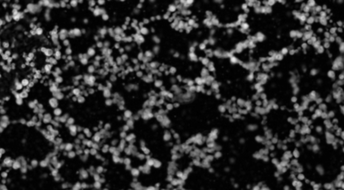 Colloidal aggregation in liquid crystal | The Hirst Lab